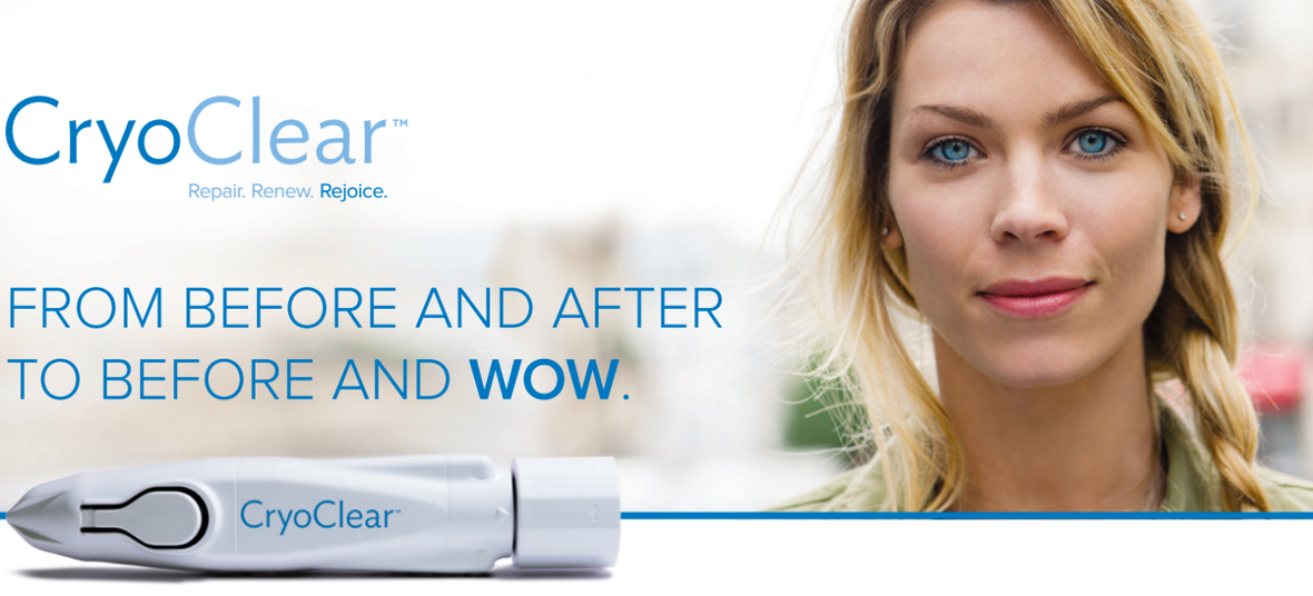 Introducing Featured Member CryoConcepts