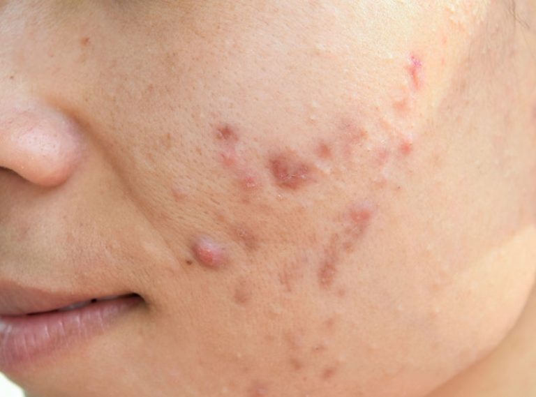 Somi – An Aggressive Child | Sleepless Husband | End of Life Remedies ...